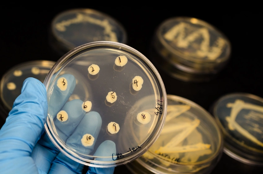 E. coli Outbreak in the UK: One Death Linked to Contaminated Salad ...